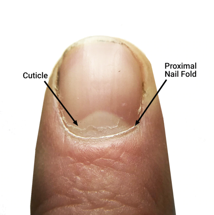 Five Effective Ways To Get Healthy Nails In This Winter